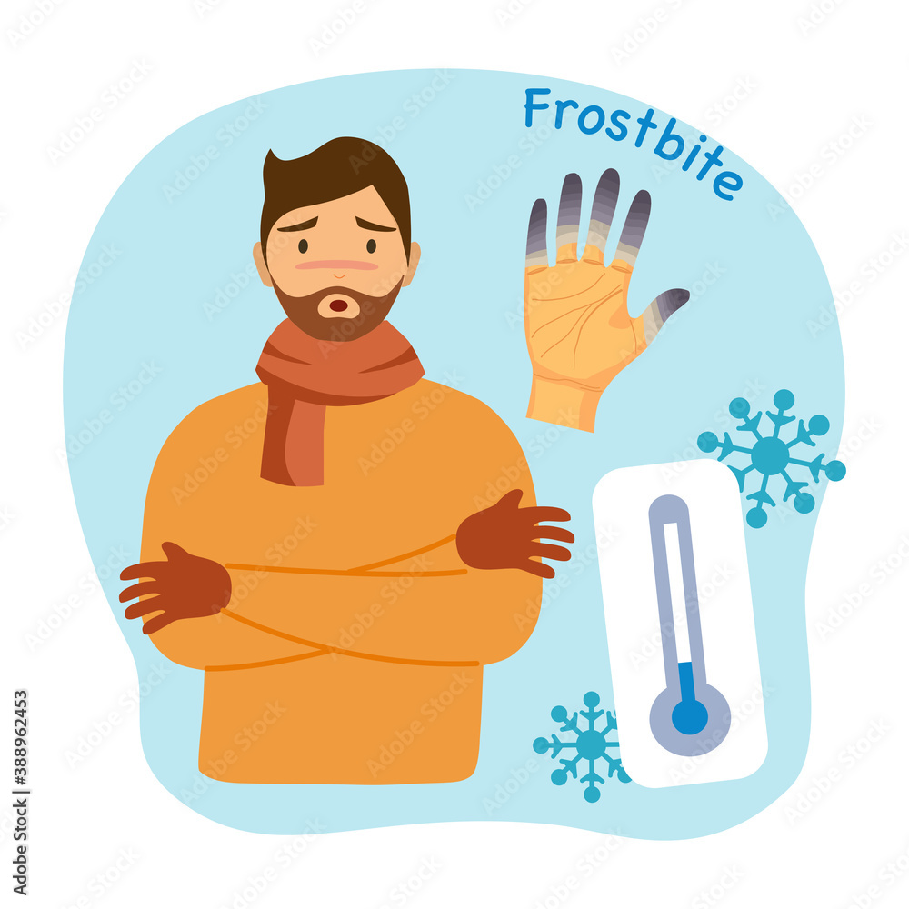 Man suffering from frostbite symptom. Guy with frozen hands in winter ...