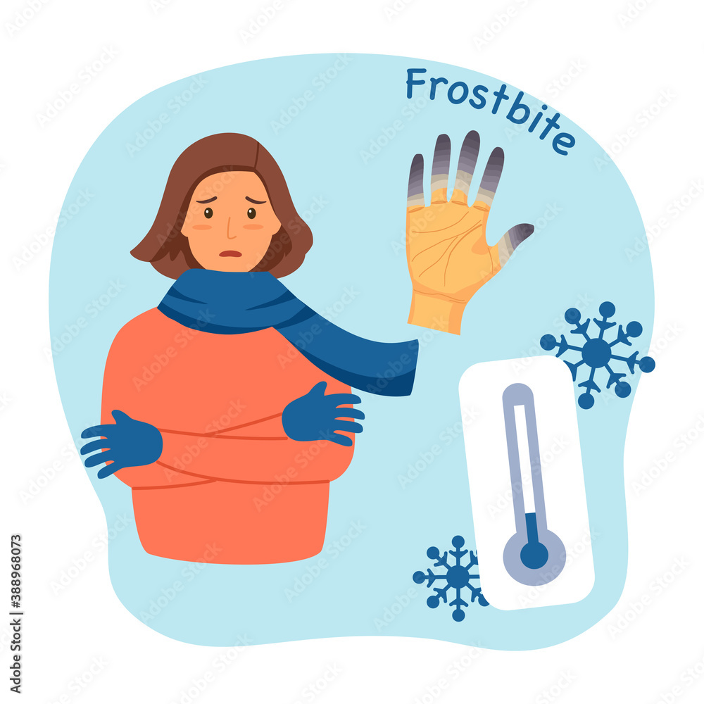 Woman suffering from frostbite symptom. Female with frozen hands in ...
