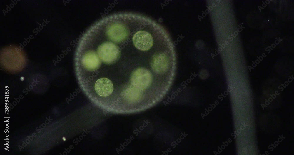 Volvox in drop of water under the microscope for classroom education ...
