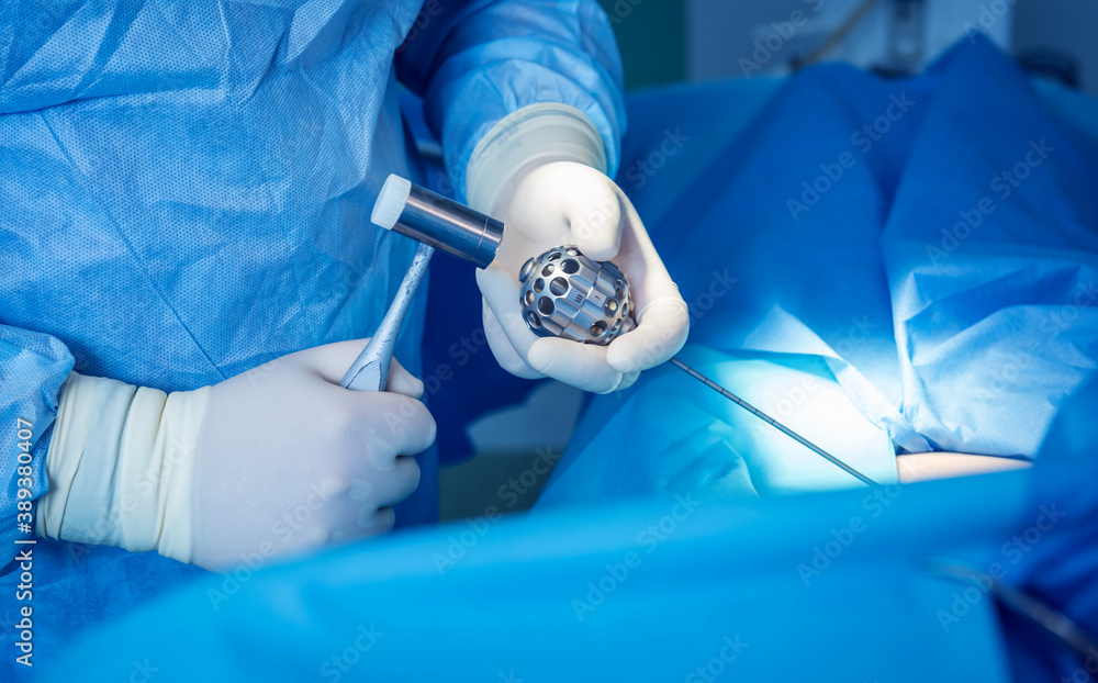 Surgeon performs endoscopic microdiscectomy of herniated intervertebral ...