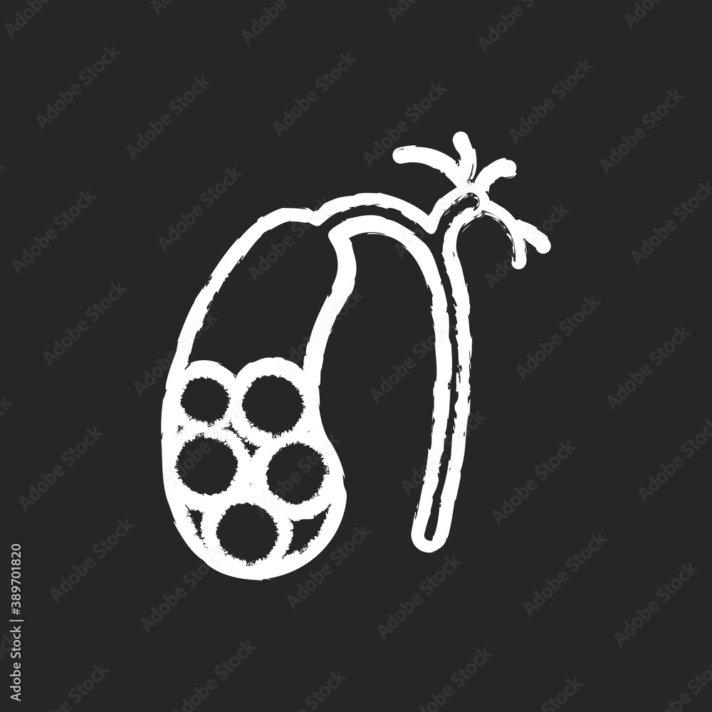 Gallstones chalk white icon on black background. Cholelithiasis ...