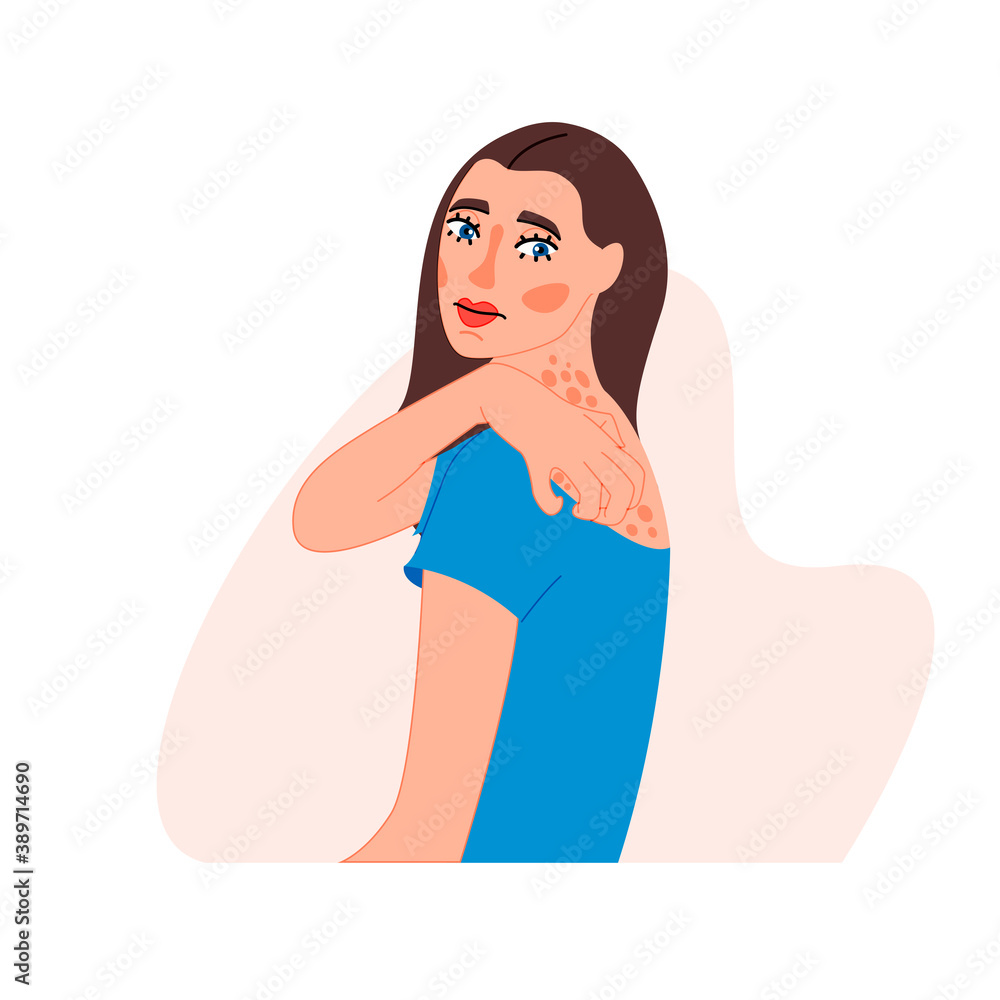Cartoon Woman With Rash