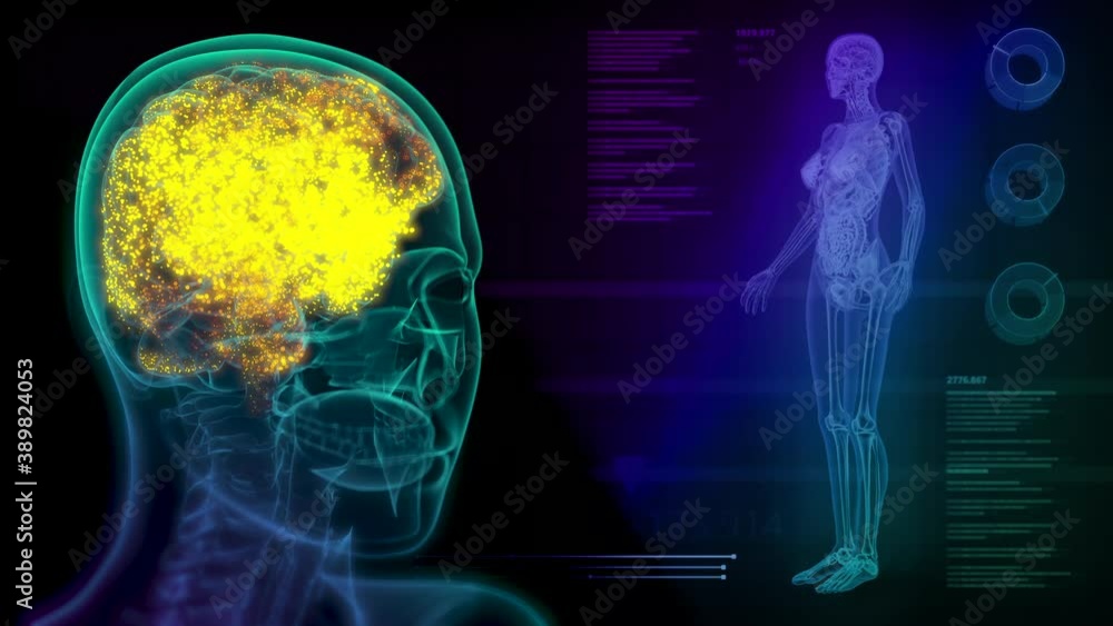 Mind activity - neural impulses flash in human brain, neurosurgery ...