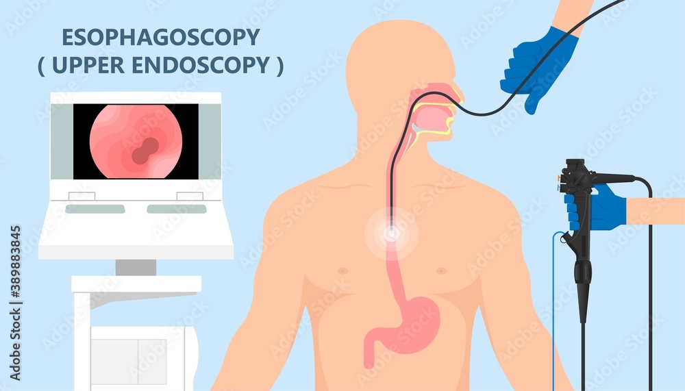 Poster Dysphagia infection trachea examine Surgery choking gastric ...