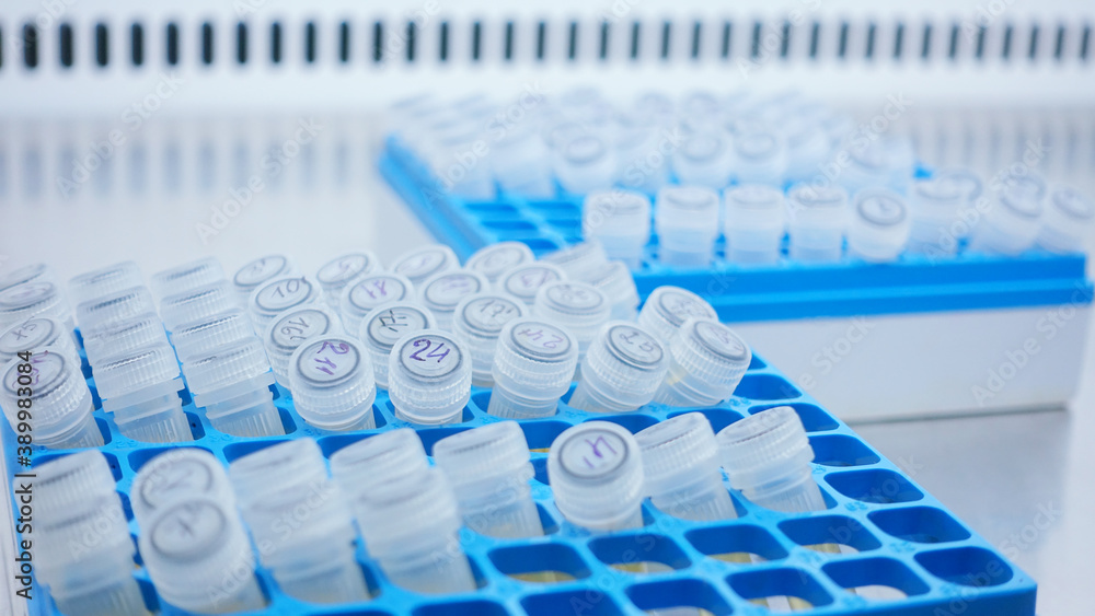 Small test tubes in a blue rack are stacked together. Collection of ...