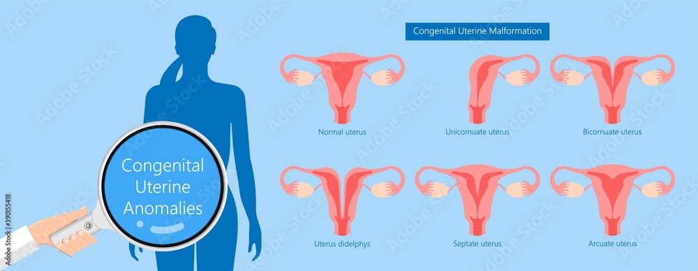 Abnormal uterus Tipped septum missed mature cervix double absent defect ...