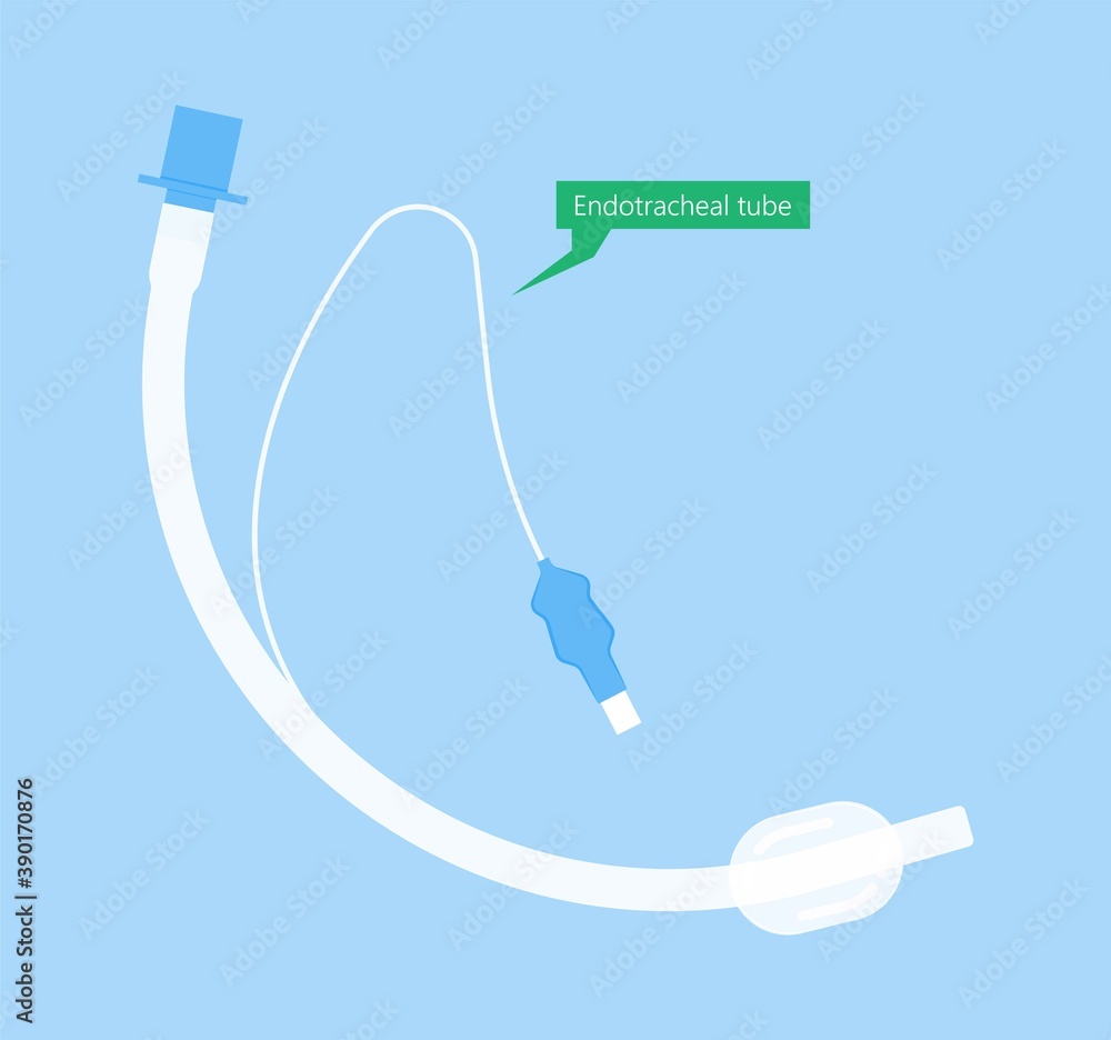 Endotracheal intubation ICU care unit COVID 19 larynx throat rescue ...