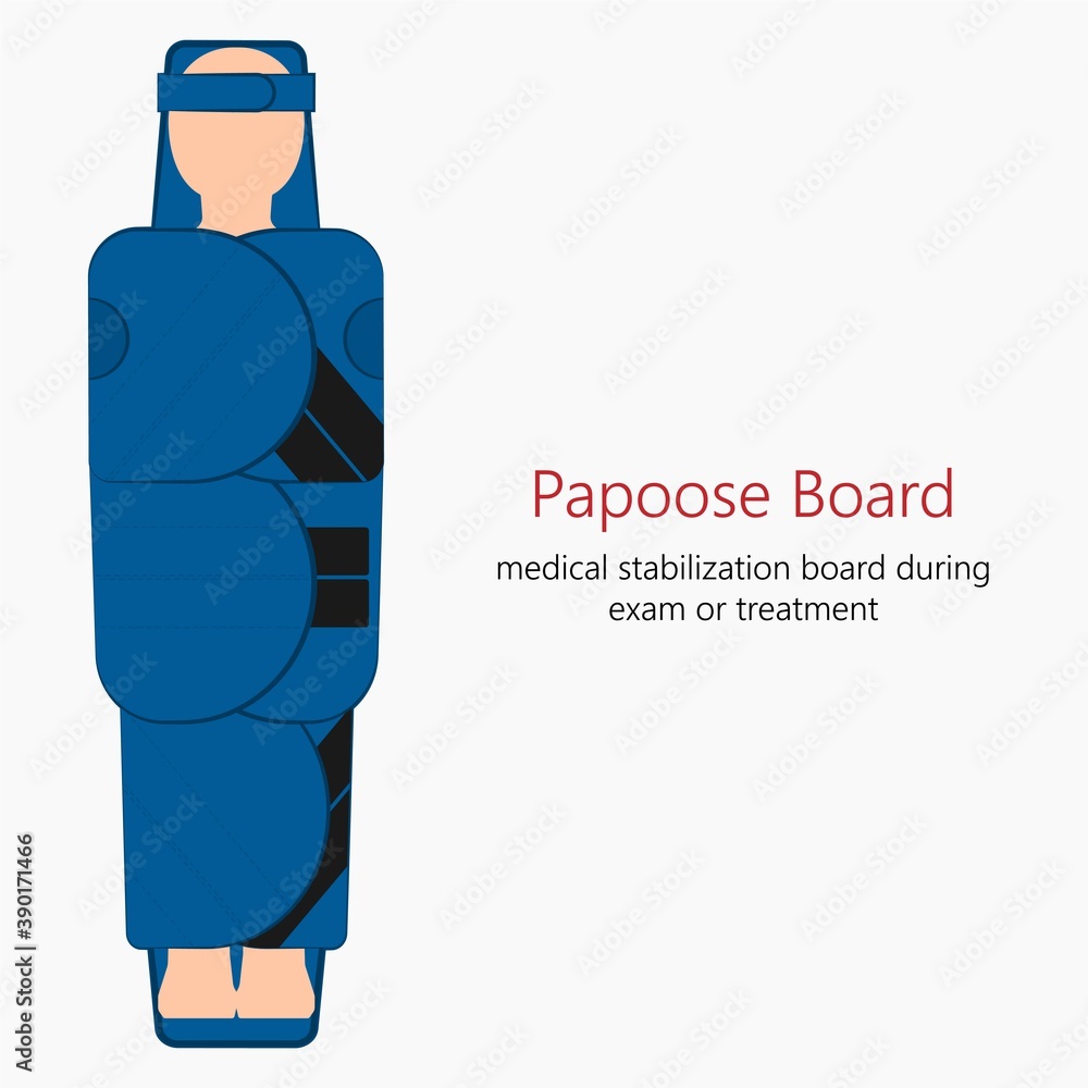 Papoose board medical equipment patient procedure autonomic nervous system Stock Vector | Adobe ...