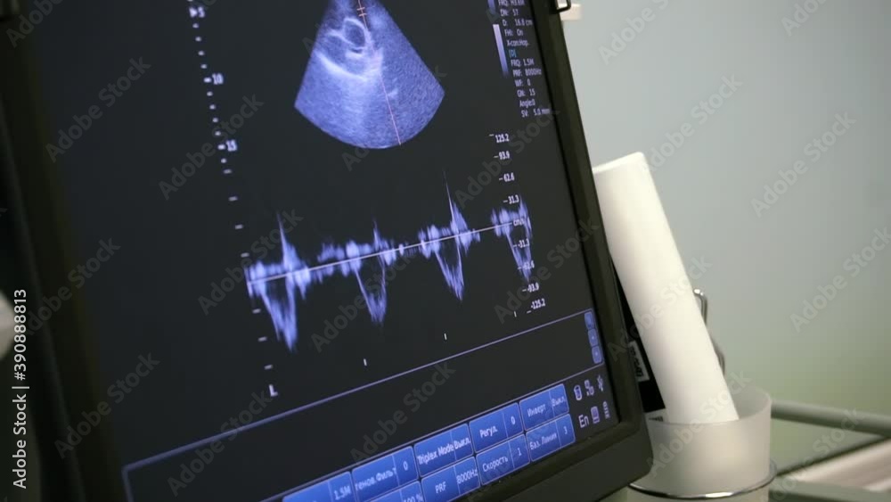 slow motion close-up display of medical device. Examination of the ...