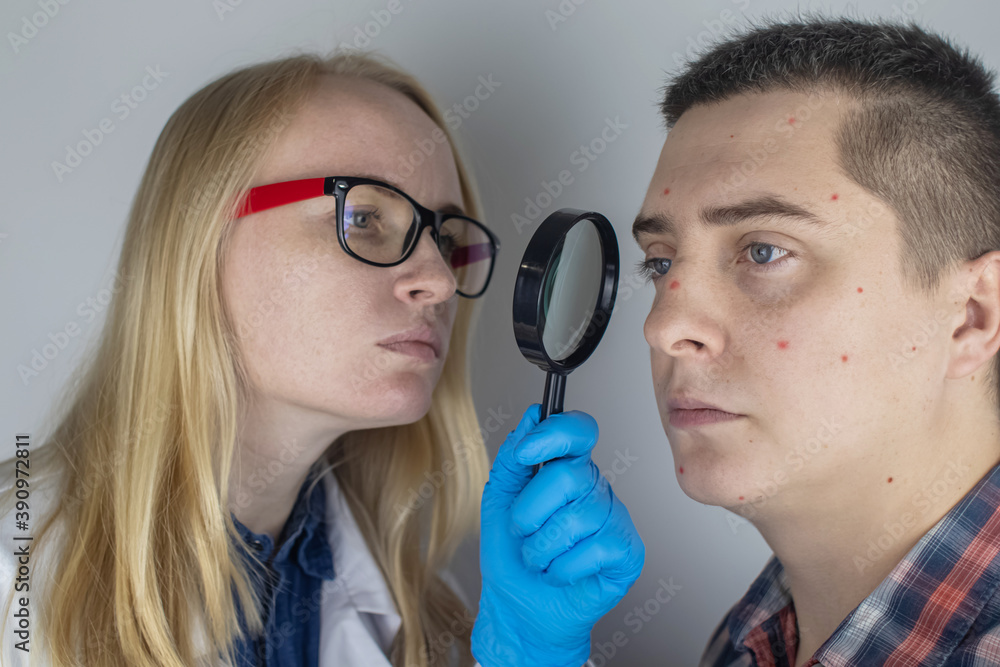 Acne close-up. A man is being examined by a doctor. Dermatologist ...
