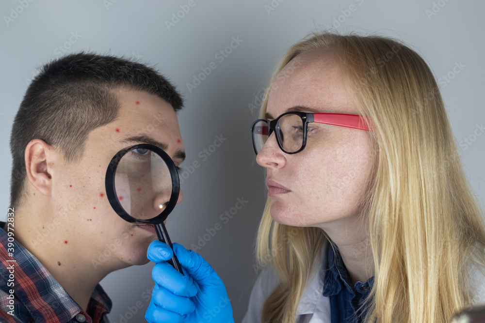 Acne close-up. A man is being examined by a doctor. Dermatologist ...