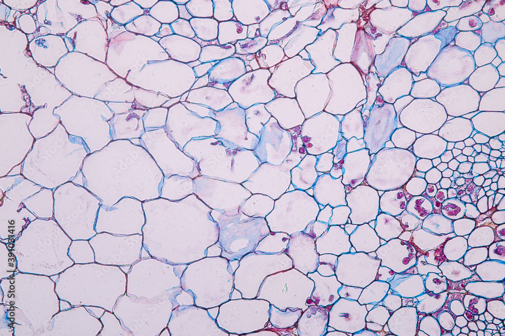 Zygomycota, or zygote fungi ,Downy mildew of cruzifers host tissue with ...