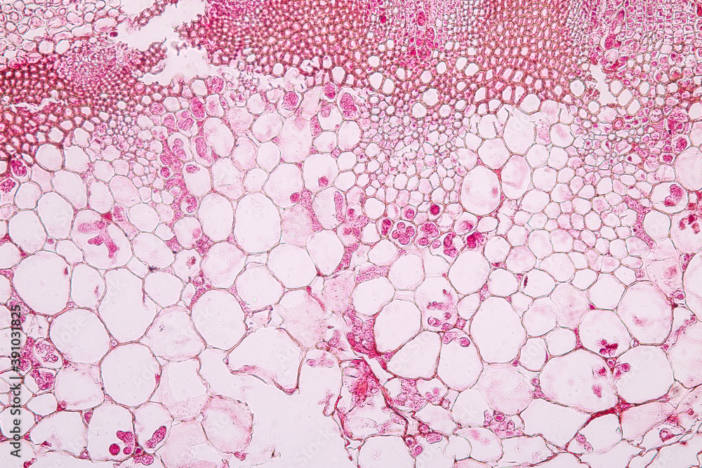 Zygomycota, or zygote fungi ,Downy mildew of cruzifers host tissue with ...