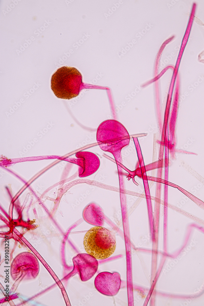 Characteristics of Rhizopus is a genus of common saprophytic fungi on ...