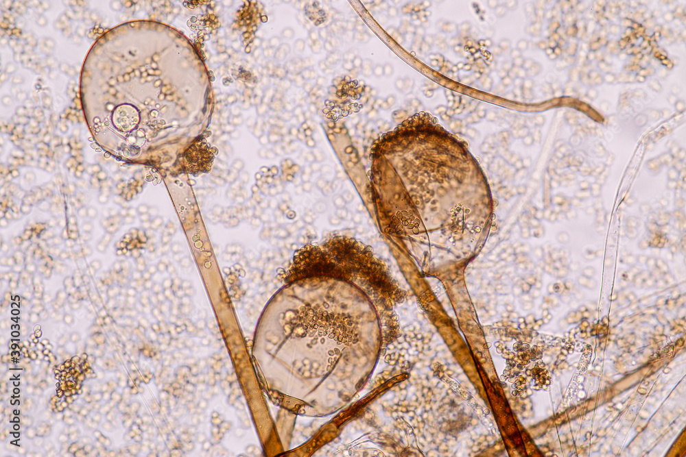 Characteristics of Rhizopus is a genus of common saprophytic fungi on ...