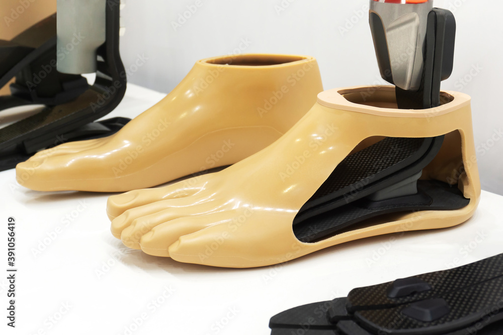 Artificial foot for a bionic prosthesis. High-tech prosthetic limbs ...