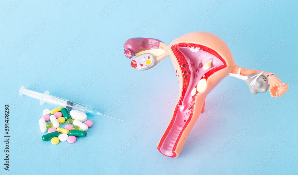 Mock up of the female reproductive system and a bunch of pills and ...