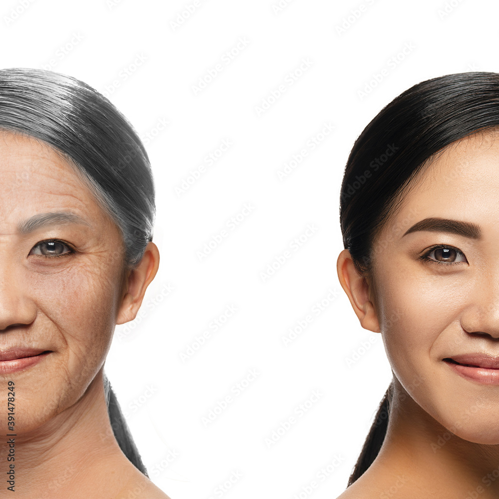 Comparison. Portrait of beautiful asian woman with problem and clean ...