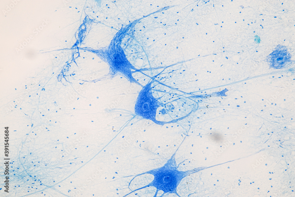 Motor Neuron Microscope