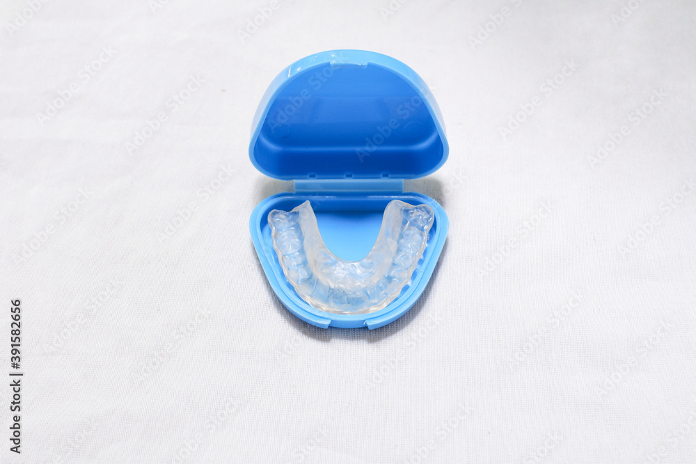 Oral splint for TMD or TMJ Disorders Stock Photo | Adobe Stock Oral splint for TMD or TMJ Disorders Stock Photo | Adobe Stock