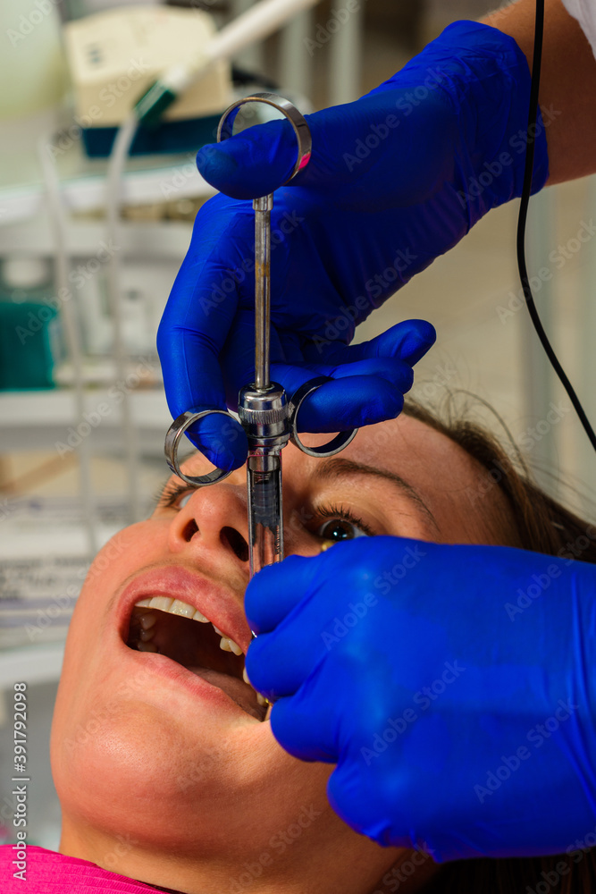 The dentist with the help of a carpule syringe injects anesthesia into ...