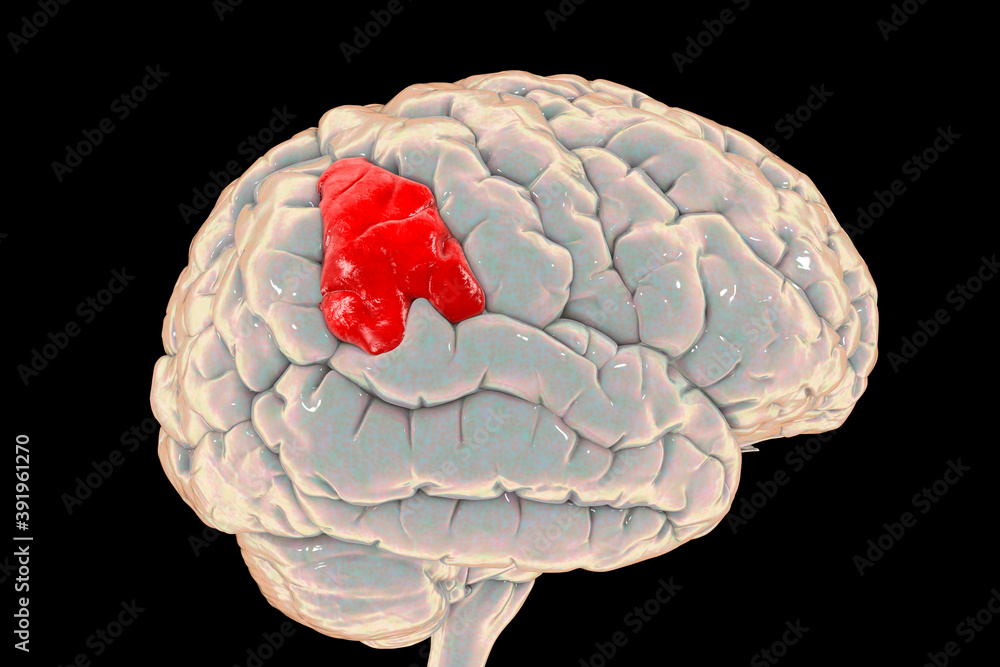 Human brain with highlighted supramarginal gyrus Stock Illustration ...