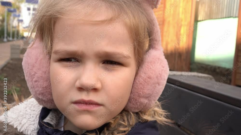 A bruise on the little girl's left eye. bruised eyelid. Stock Video ...