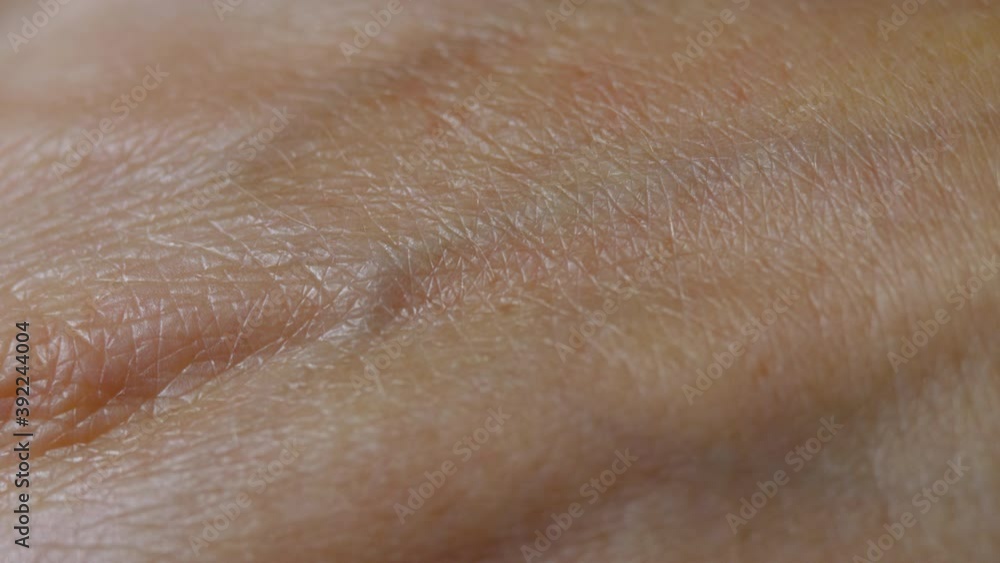 Macro Shot of Really Dry Old Human Skin. Close up Skin Texture With ...