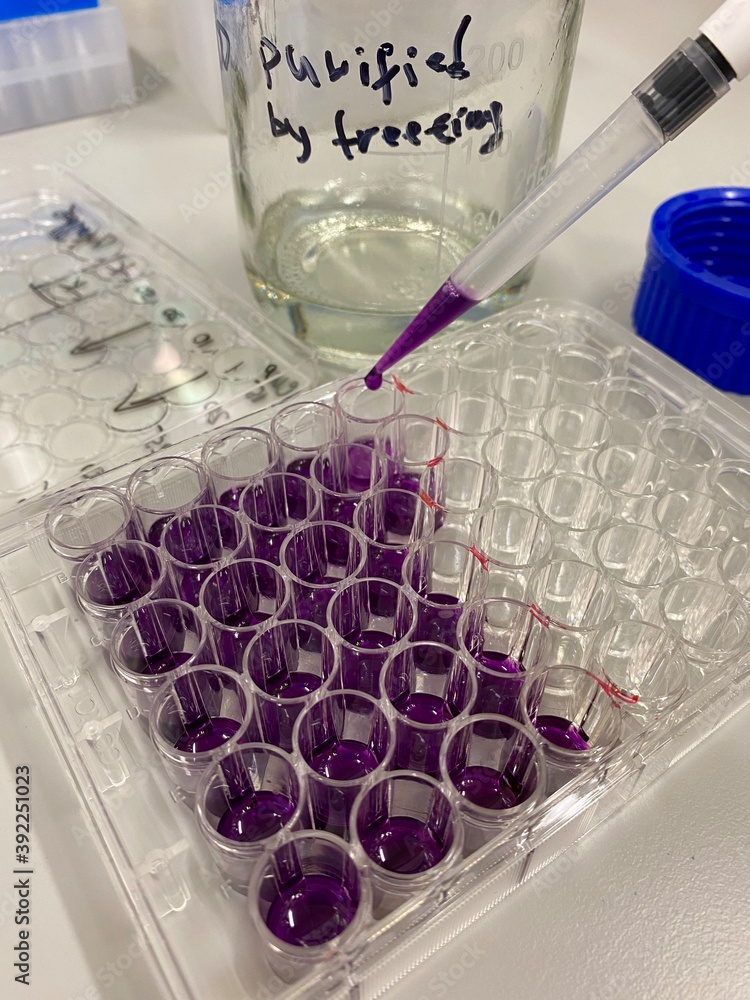 MTT assay protocol for measuring cell viability, proliferation and ...