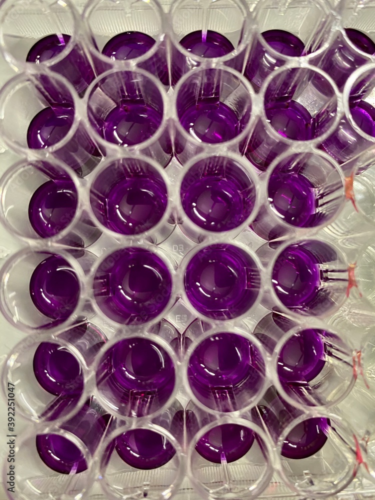 MTT assay protocol for measuring cell viability, proliferation and ...