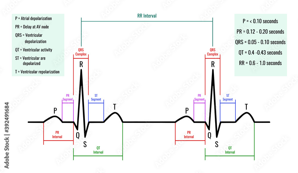 illustration of ECG interpretation. ECG of a healthy person.Useful for ...