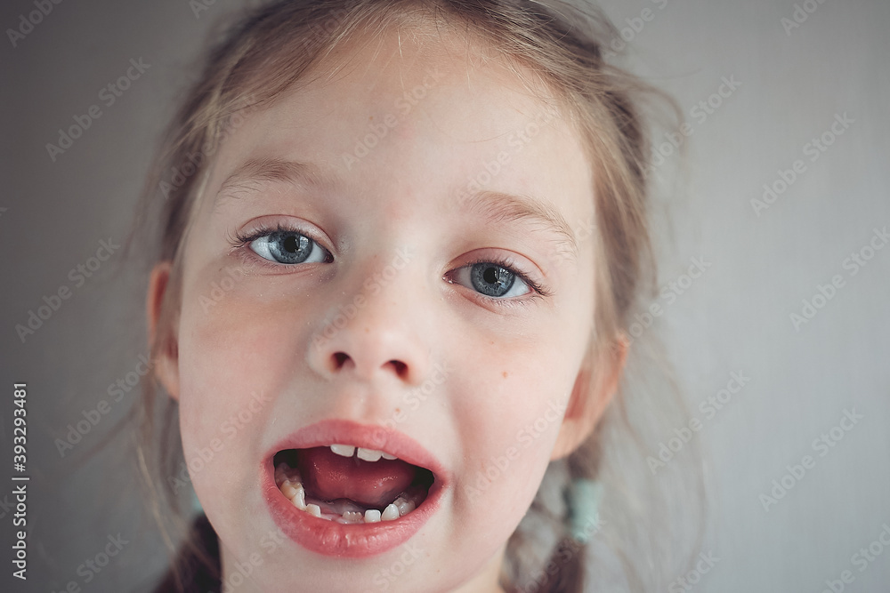 first baby teeth that fell out, portrait of a girl with her front teeth ...