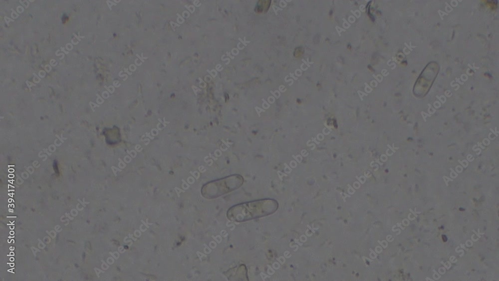 Microscopy of Coccidia organisms in a rabbit feces. Parasite (Eimeria ...