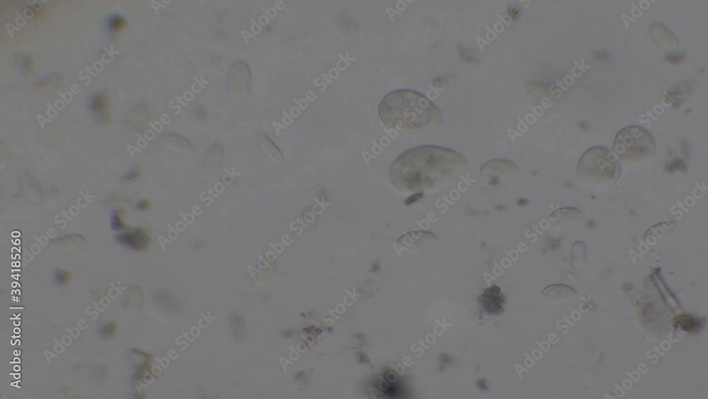 Microscopy of protozoa microorganisms in the water sample, showing ...