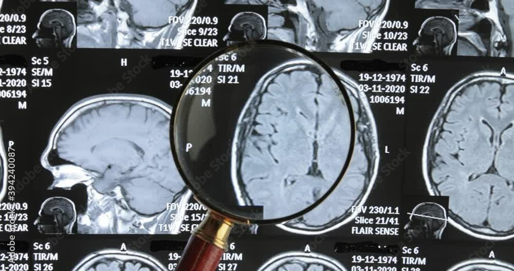 Mri brain scan background, magnetic resonance tomography. The doctor ...