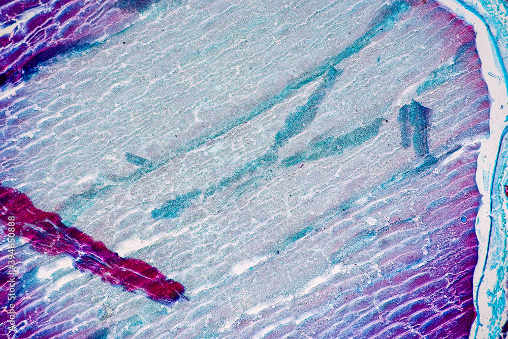 Slime molds, as a group, are polyphyletic under the microscope for ...