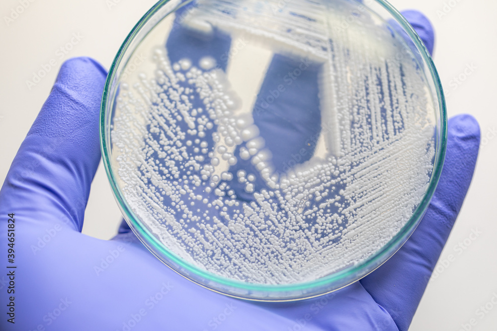 Pichia is a genus of yeasts in the family Saccharomycetaceae under the ...