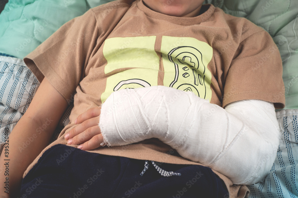 little boy lies on the bed with a fractured limb. a child's arm is ...