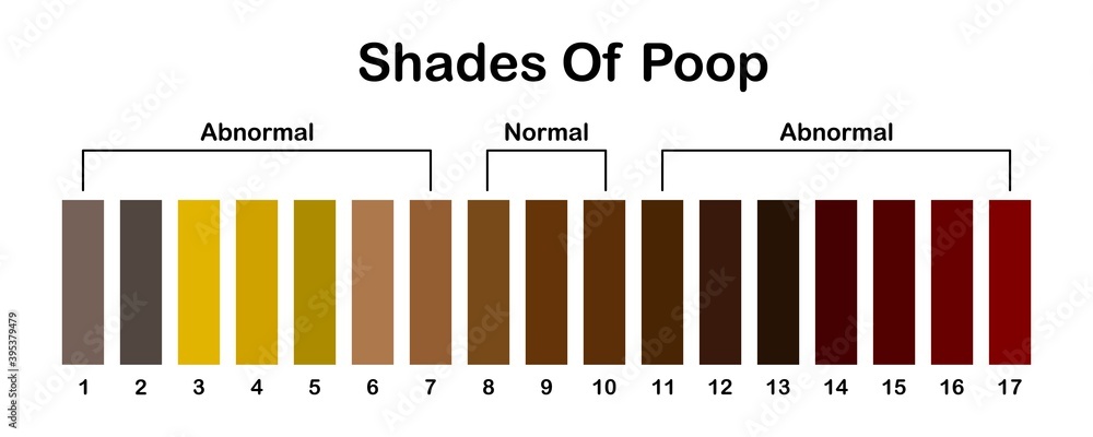 Shades color of poop. Human feces color strip. Healthy concept. Normal ...