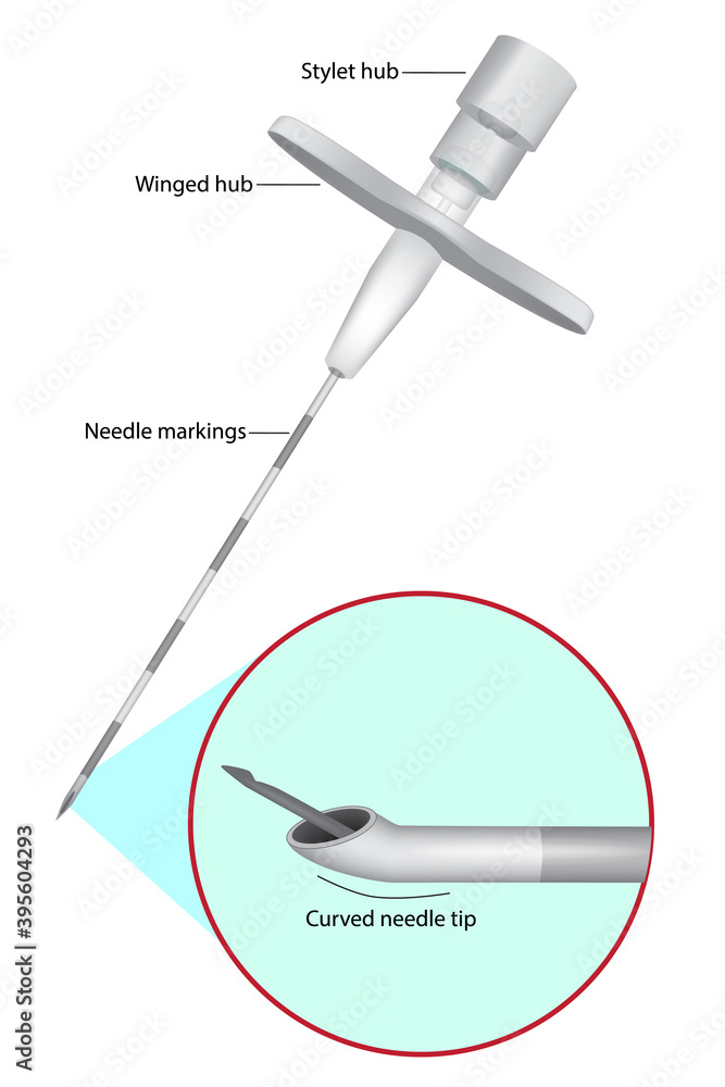 Tuohy Epidural Needle. Epidural administration Vector illustration ...