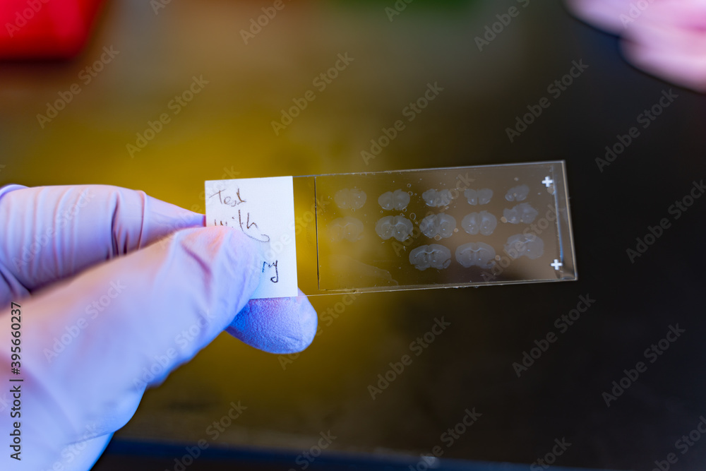 scientist holding a microscope slide with mouse brain slices Stock ...