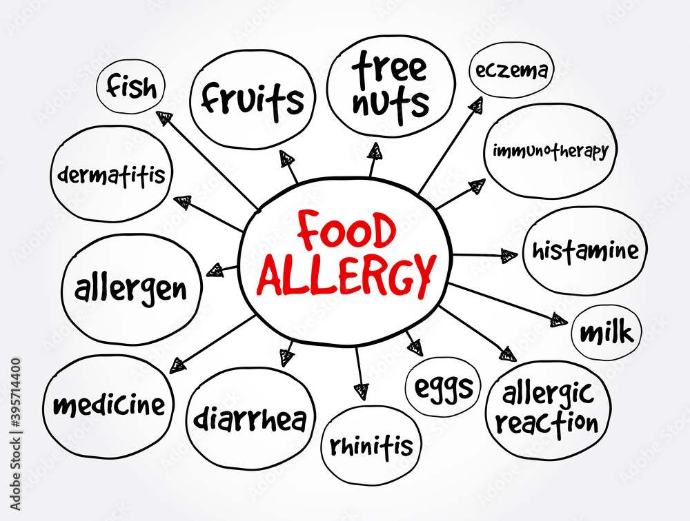 Food allergy mind map, health concept for presentations and reports ...