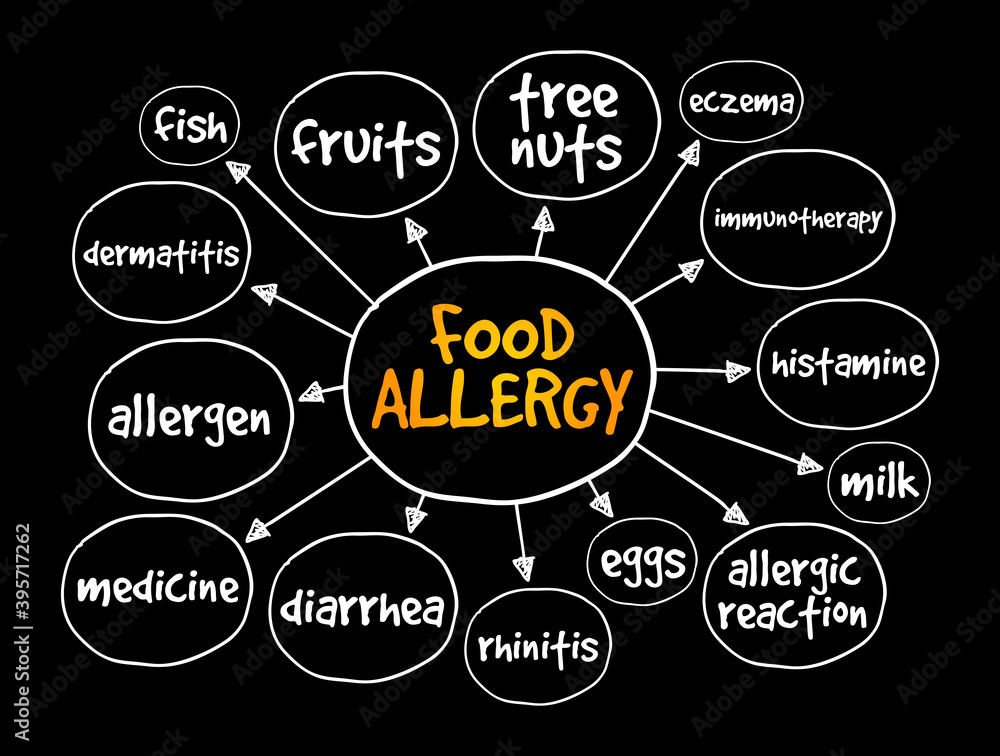 Food allergy mind map, health concept for presentations and reports ...
