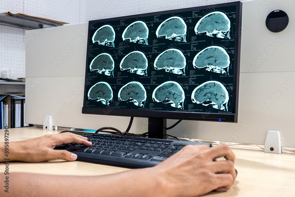 Brain MRI, head scans and tumor detection. Diagnostic medical tool ...