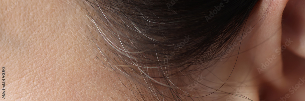Black and gray hair on temples of head. Causes of early gray hair ...