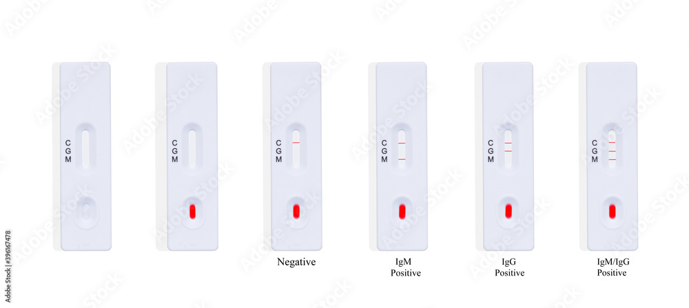COVID-19 test to detect IgM and IgG antibodies to Novel Coronavirus ...