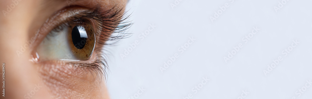 Macro eye photo. Keratoconus - eye disease, thinning of the cornea in ...