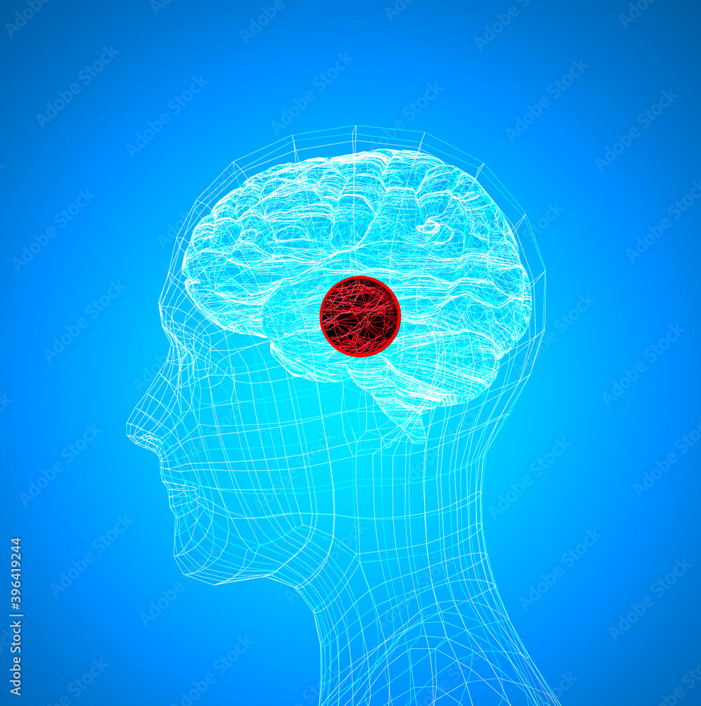 Pain in the head, brain and synapses, cognitive problems, mental ...