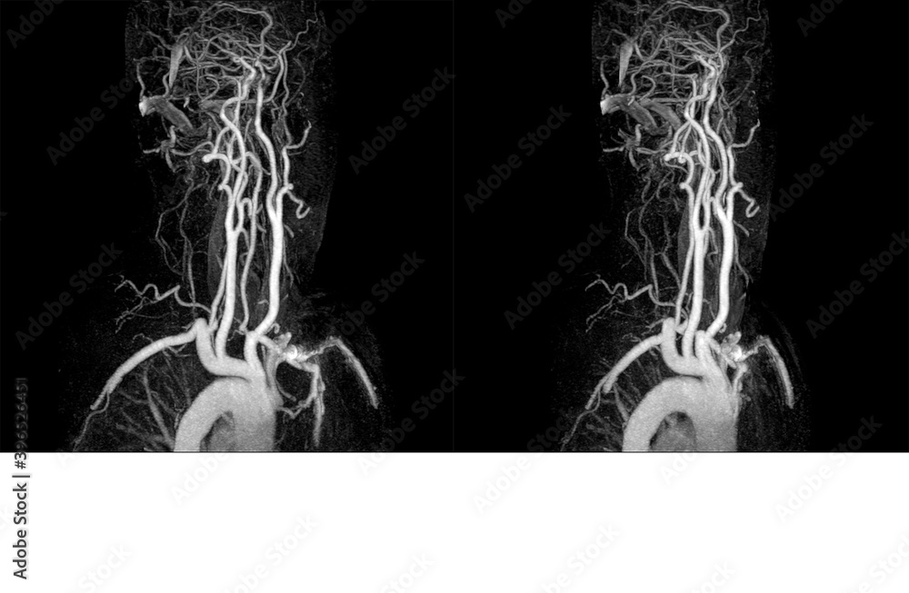 Foto de Soft and blurry image,Medical image MRI(magnetic resonance ...