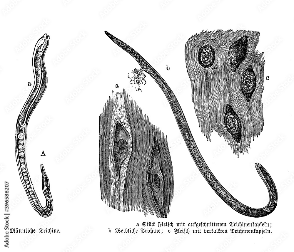 Trichinella spiralis, parasite responsible for the disease trichinosis ...